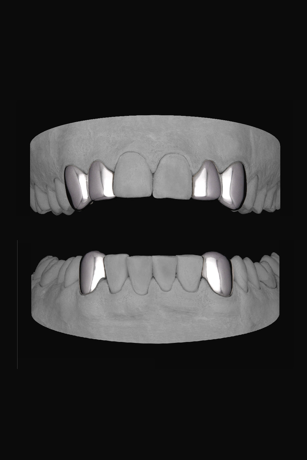 2 x Canine and Lateral & Bottom Canines – K9GrillzUK