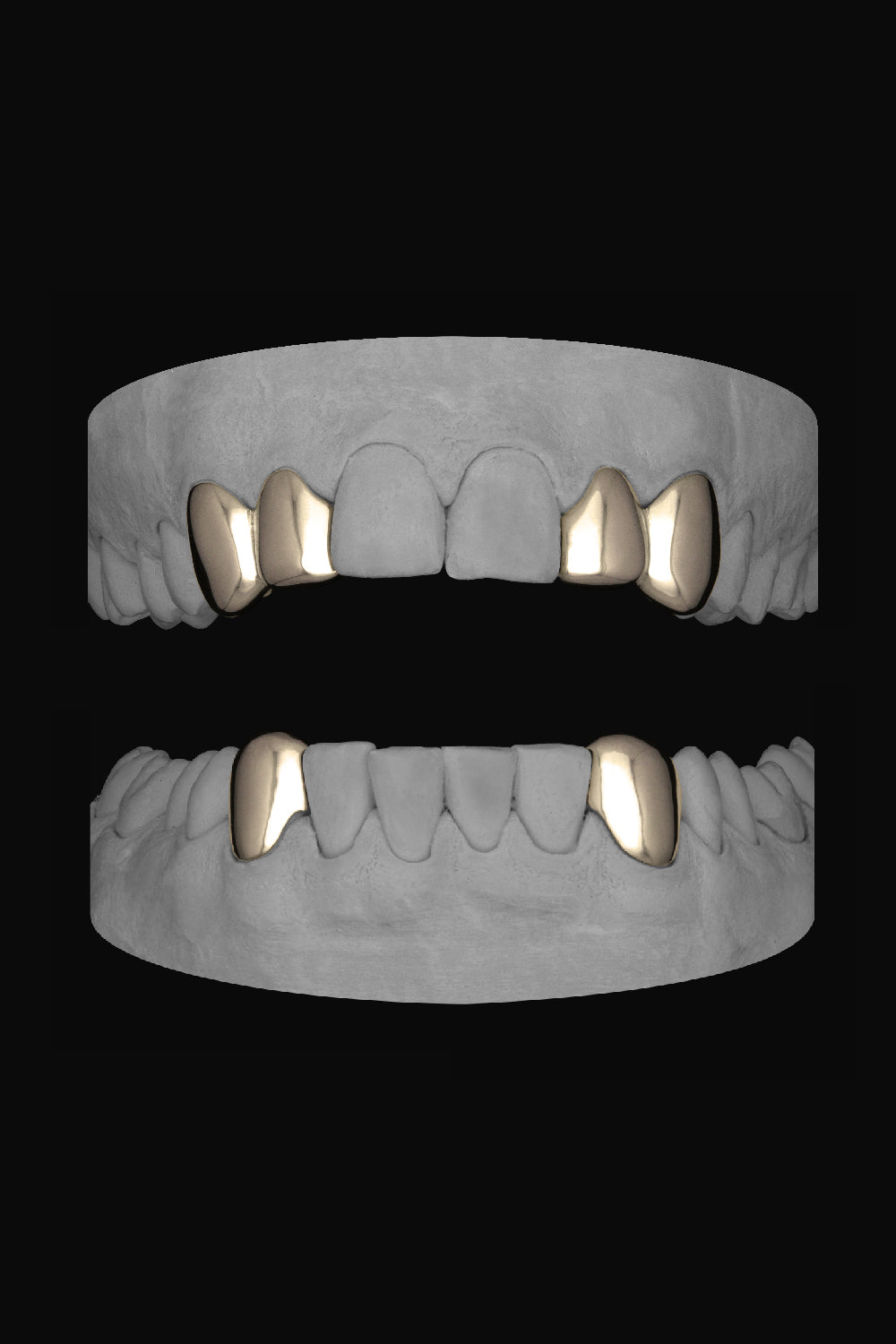2 x Canine and Lateral & Bottom Canines – K9GrillzUK