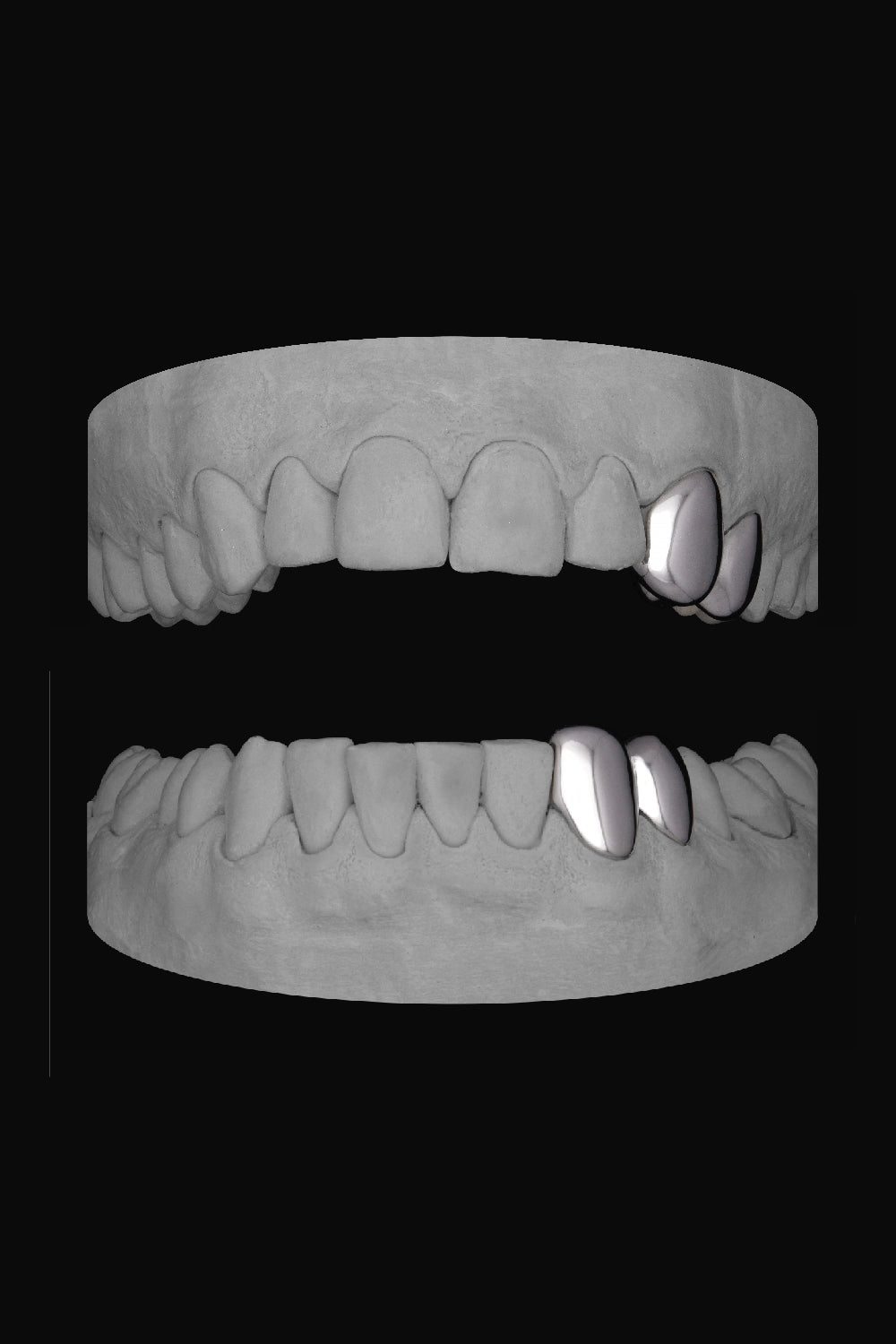 2 x Canine & Premolar (Upper & Lower) – K9GrillzUK