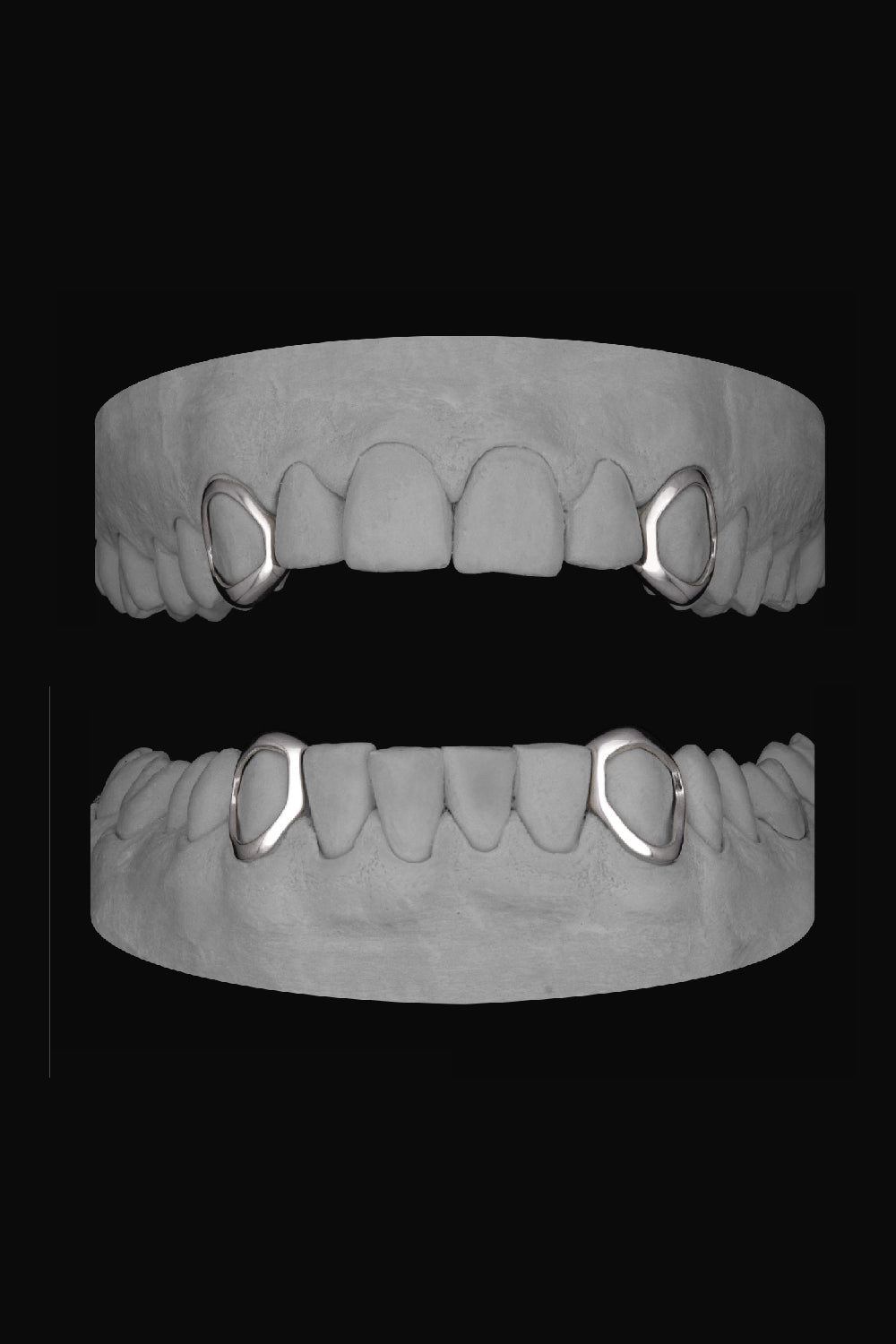Silver Teeth Grillz Window And Solid Cap Set