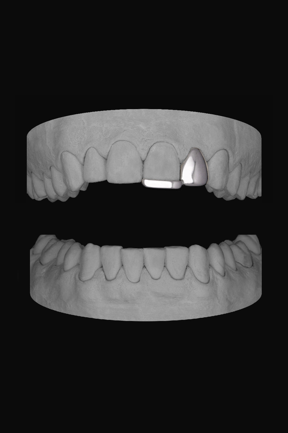 Lateral & Bar – K9GrillzUK