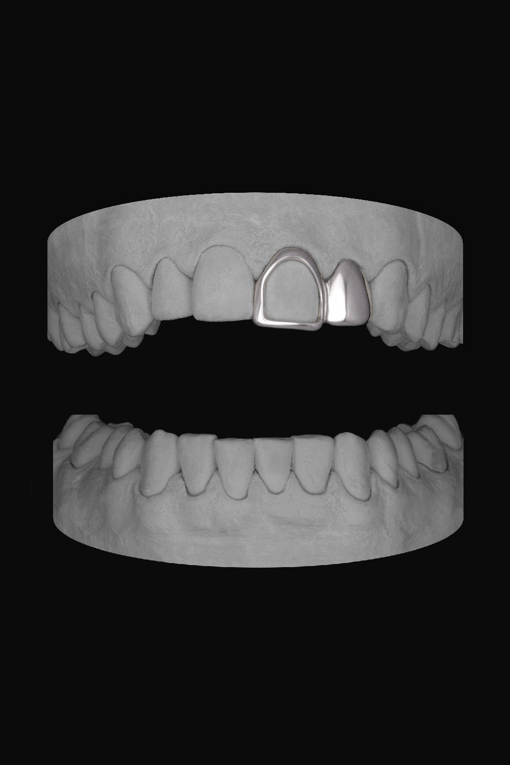 Lateral & Window Front – K9GrillzUK